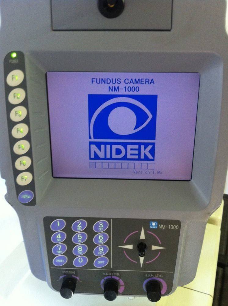 Nidek NM-1000 Fundus Camera Non-Mydriatic | seaophthalmic